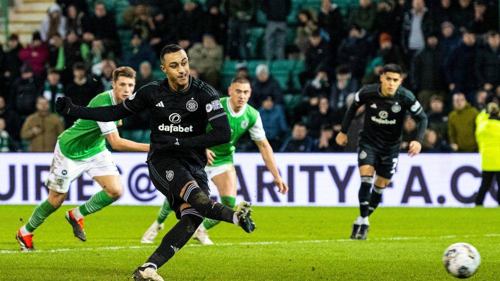 Match Gallery: Hibernian v Celtic - Celtic FC - 8 Feb