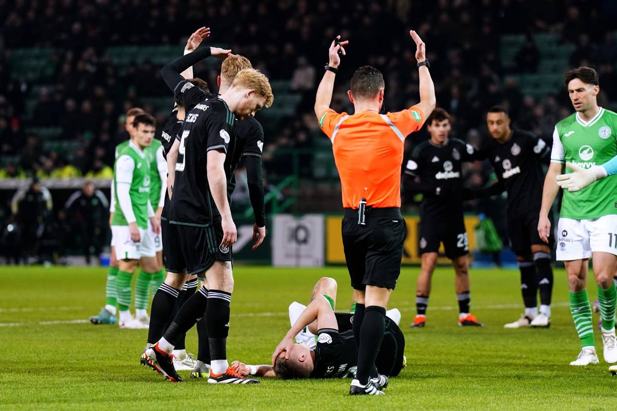 Johnston suffers ‘suspected fracture’ with Celtic head knock - Herald ...
